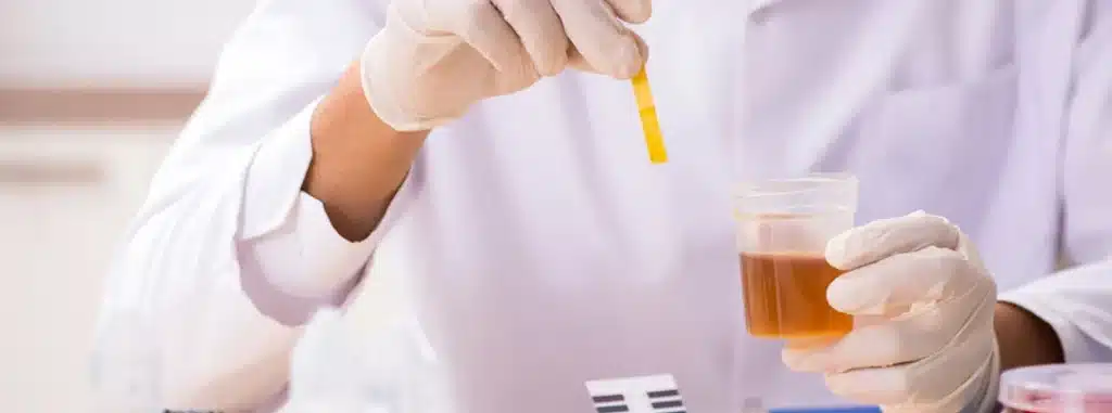 Meth in Urine: A Guide to Understanding Drug Testing Results