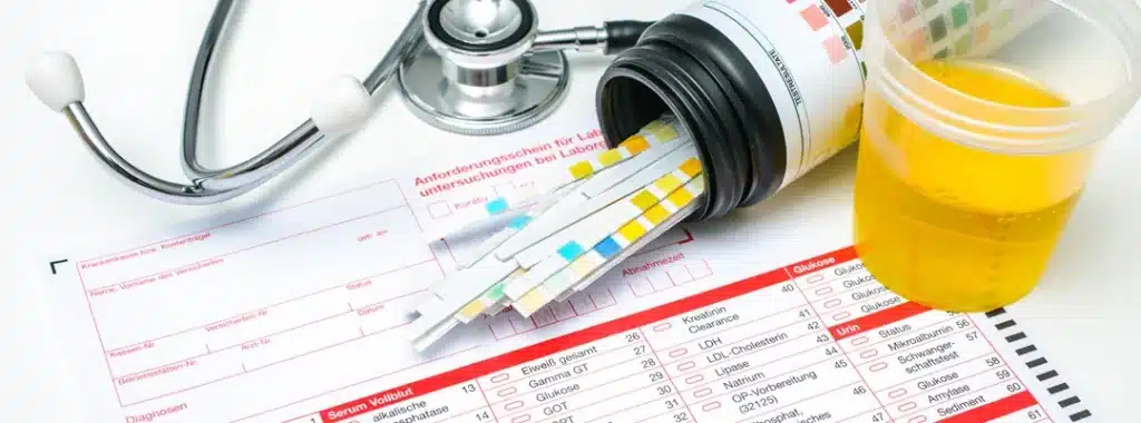 Meth in Urine: A Guide to Understanding Drug Testing Results