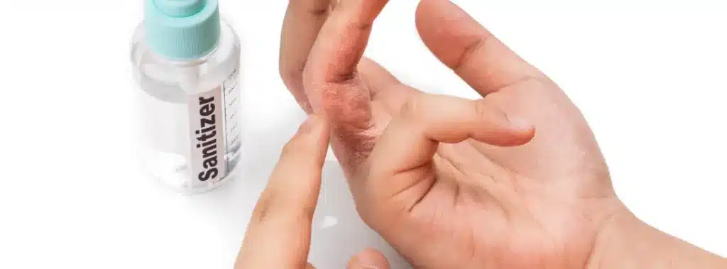 What are Meth Mites? | Purpose Healing | Get Support Now