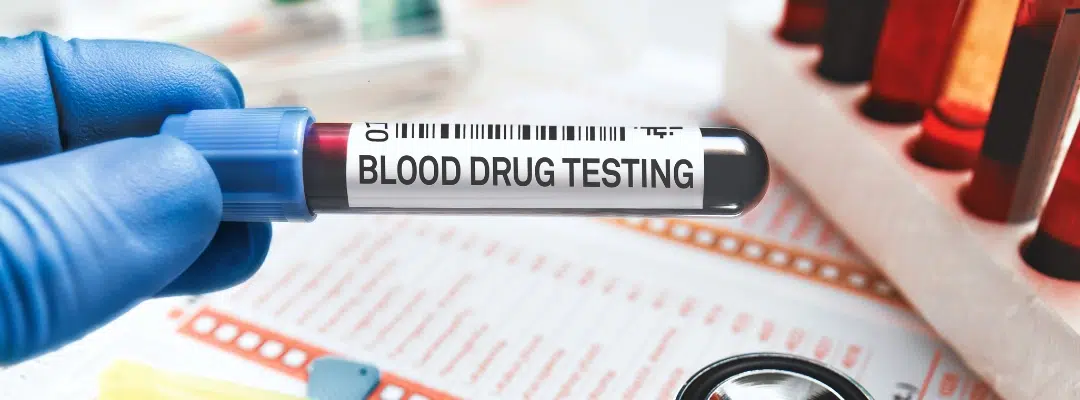 Does Alcohol Show Up on A Drug Test for Work? | Find Support