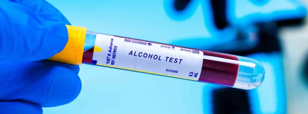 Relapse Autopsy Guide and Worksheet | Purpose Healing Center