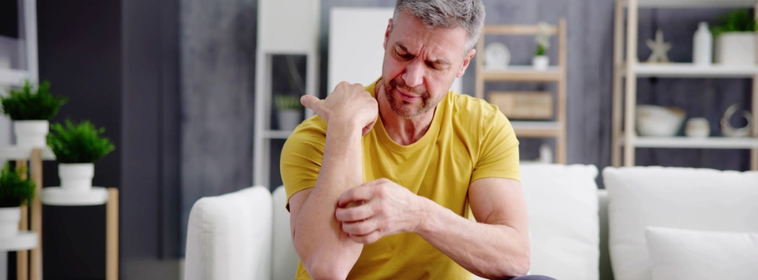 How to Treat A Skin Rash from Alcohol Abuse | Find Support